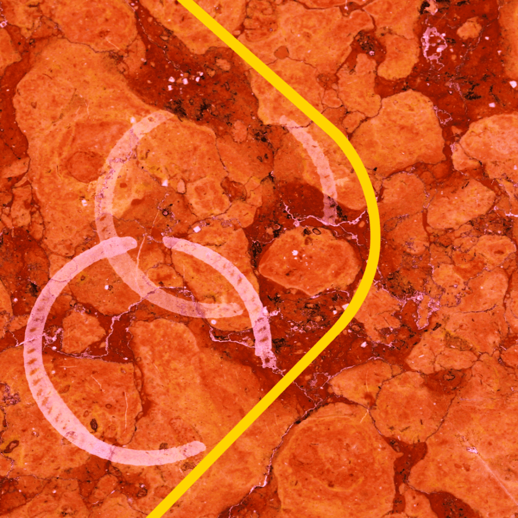 5 Common Surface Blemishes Plus the Stain Removers That’ll Help Save ...